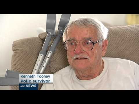 ABC News: Australia’s forgotten disability – Post Polio Syndrome – Post ...
