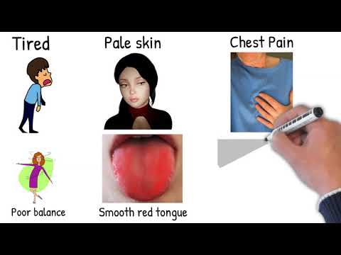 Pernicious anemia vs Vitamin B12 deficiency anemia made easy