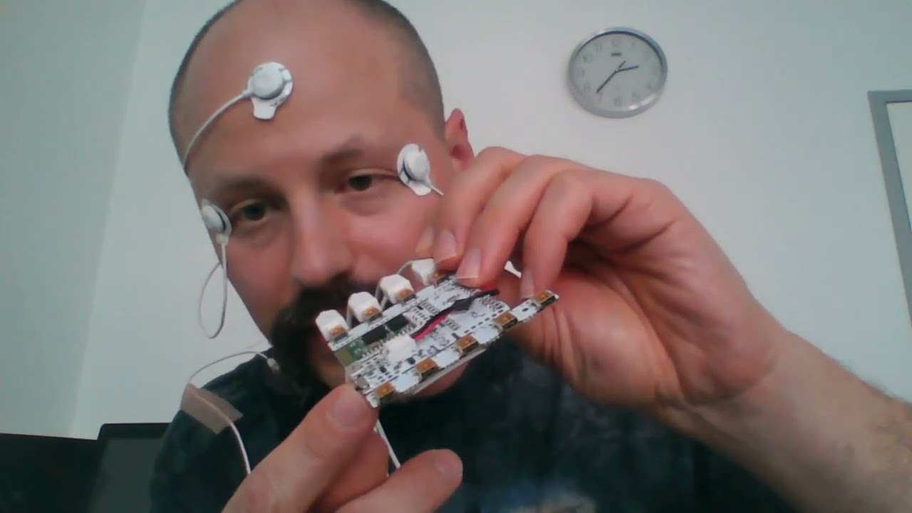 03 EOG electrodes installed