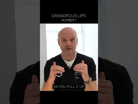 Recognizing High-Risk Lips for Lip Lift Surgery