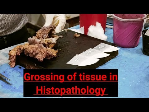 Grossing of tissue in Histopathology ll grossing tissue techniques in Histopathology
