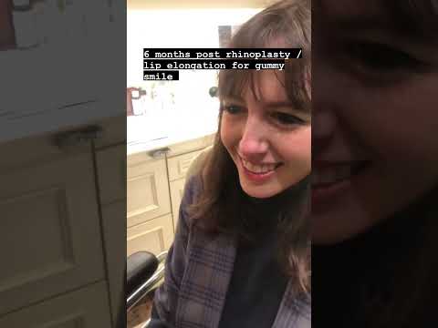 Facial Plastic Surgeon NYC | Dr. Sam Rizk