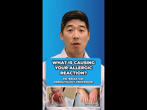 What Is Causing Your Allergic Reaction?