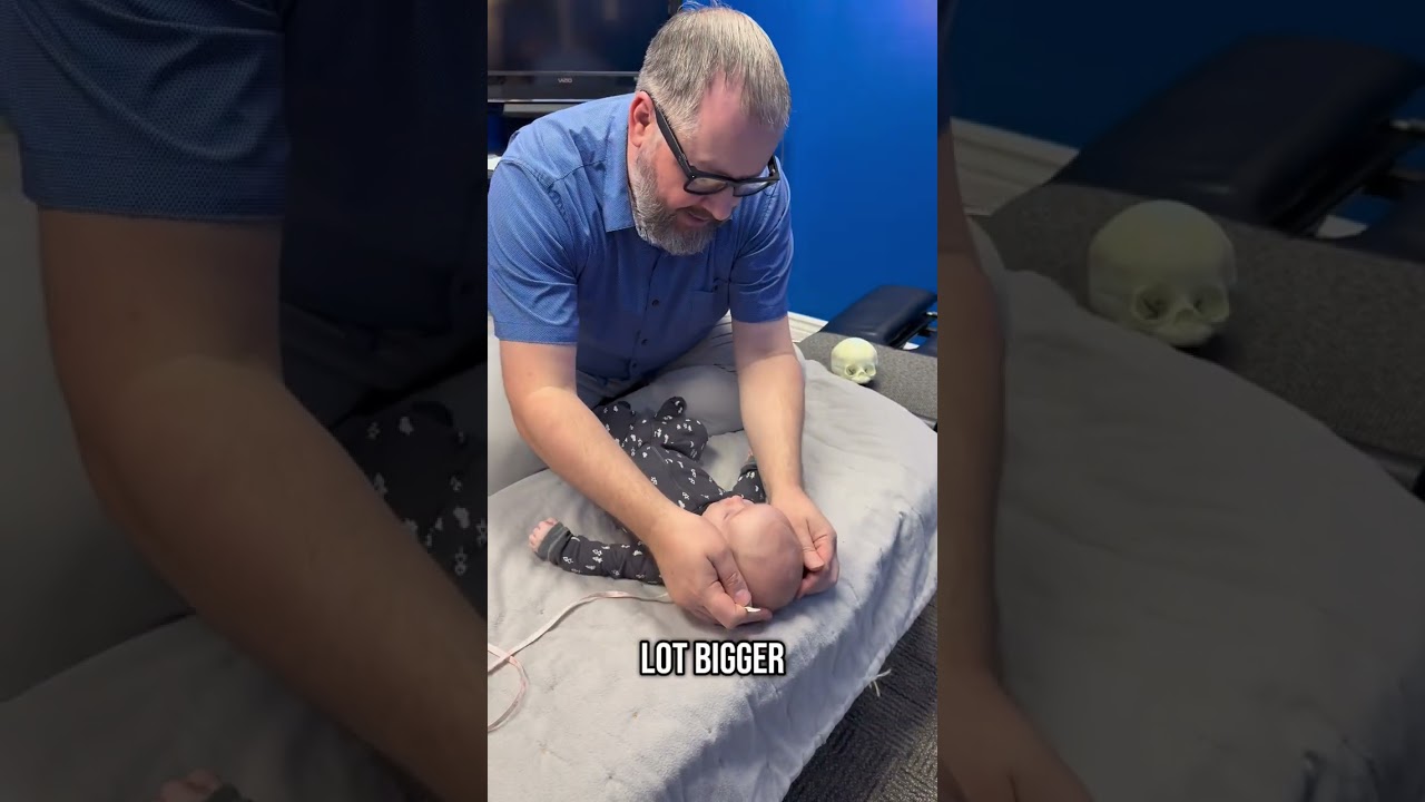 Certified Pediatric Chiropractor uses Craniosacral therapy to help this baby’s flat head