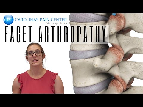 Natalie Explains Facet Arthropathy