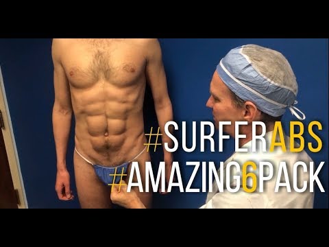 Dr. Steinbrech Reveals Body Banking and Liposuction Results 3.5 Years Later