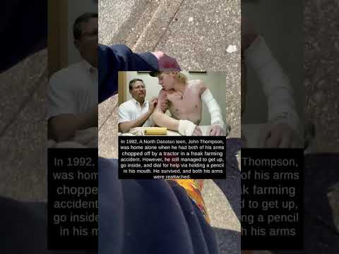 A North Dakota Teen Had Both Arms Ripped Off In Freak Farmington Accident