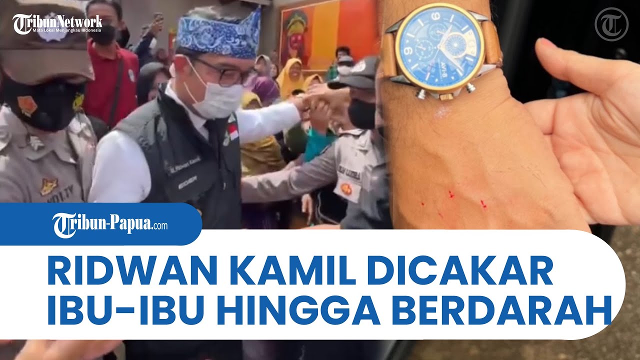 Detik-detik Tangan Ridwan Kamil Dicakar oleh Ibu-ibu hingga Terluka dan ...