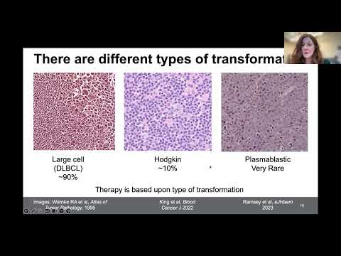 What Chronic Lymphocytic Leukemia Patients Should Know about Richter Syndrome with Erin Parry, MD