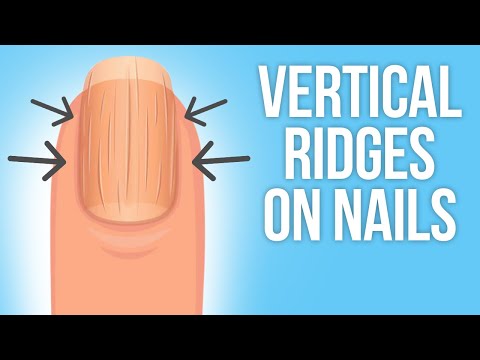 This Is WHAT Vertical Ridges on Your Nails REVEAL About Your Health