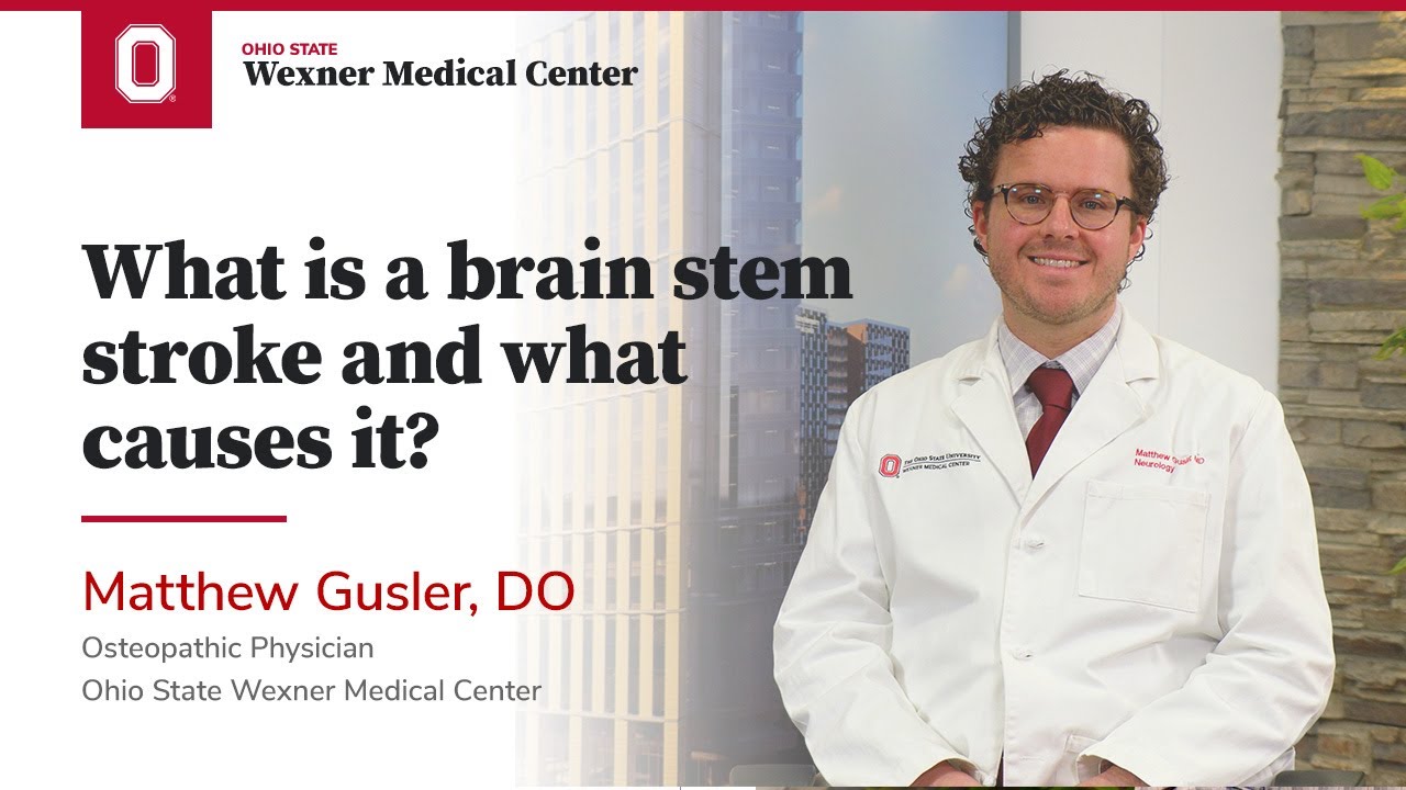 What is a brain stem stroke and what causes it? | Ohio State Medical Center