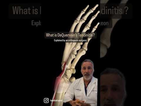 What is #DeQuervains tendinitis? Orthopedic hand surgeon explains using animation