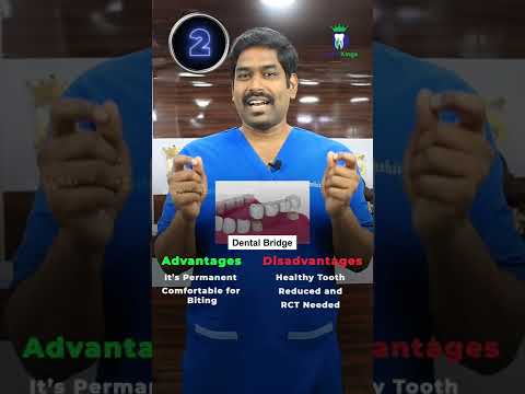 3 பல் கட்டும் முறைகள் - Teeth replacement options!!! | Denta Kings