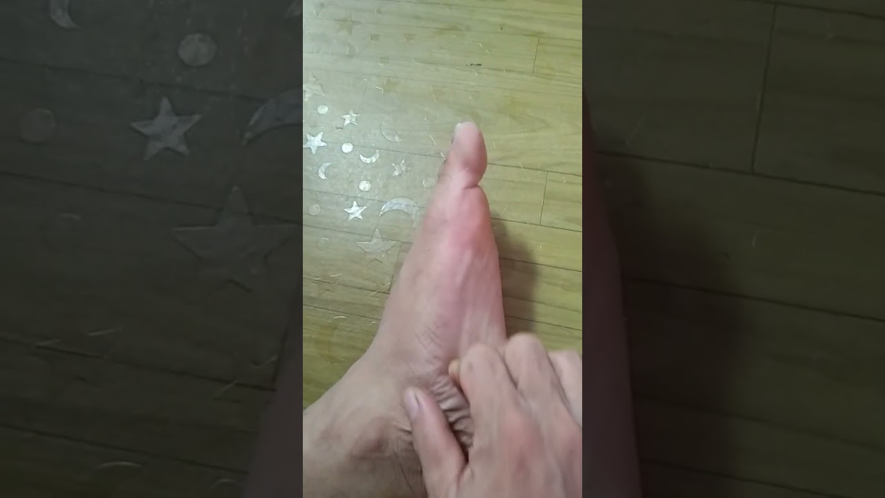 TAPAK KAKI SIHAT #massage  URUT SEKARANG