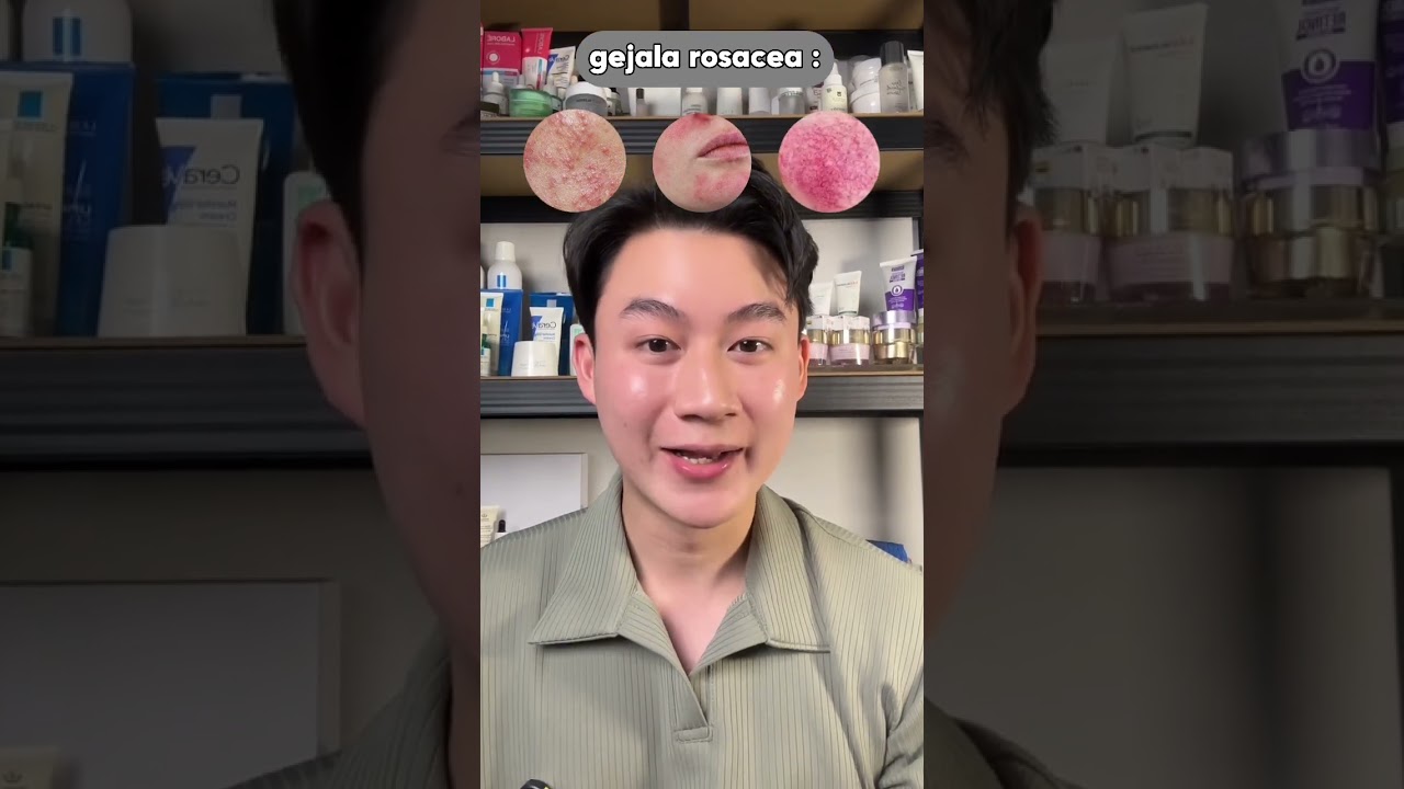 The Difference Between Acne and Rosacea: Don't Forget to Read! #acnefighter #rosacea #skinhealth