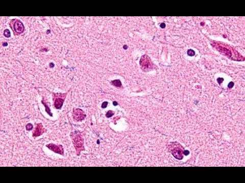 The Social Neuron Spindle cells are special neurons in the human ...