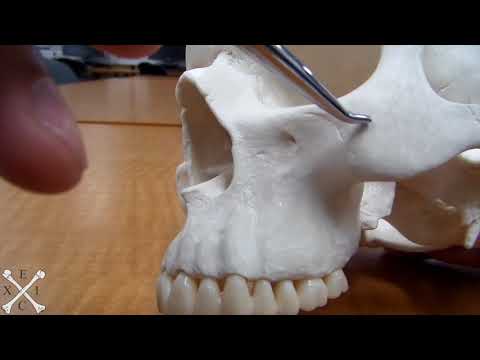 TeachMeEXCI - Zygomatic Facial Bone