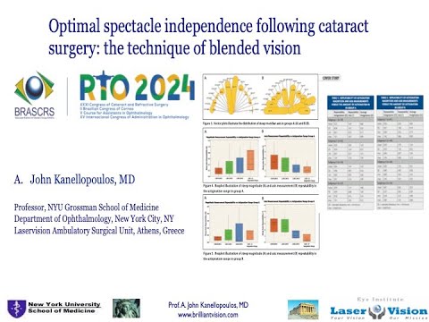 Exchange trifocalIOL, pairing with blended vision, +0.5D with-the-rule cyl: Opt distance-Inter-near