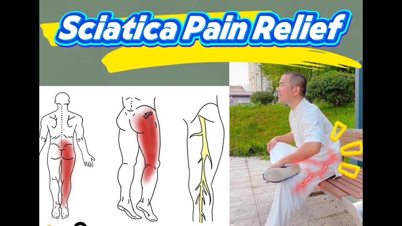 Sciatica Sufferers Are Doing This Instead of Surgery
