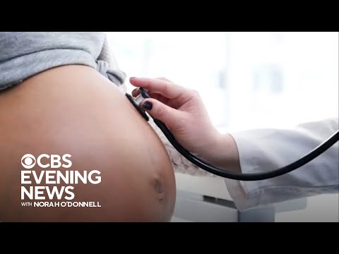 U.S. maternal mortality rose during COVID-19 pandemic, CDC data shows