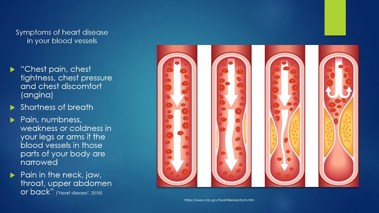 Final Presentation Cardiovascular Disease
