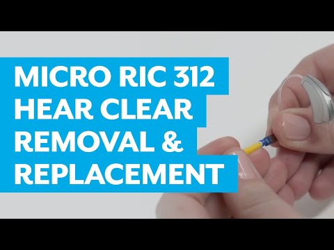 Micro RIC 312 Hear Clear Removal and Replacement