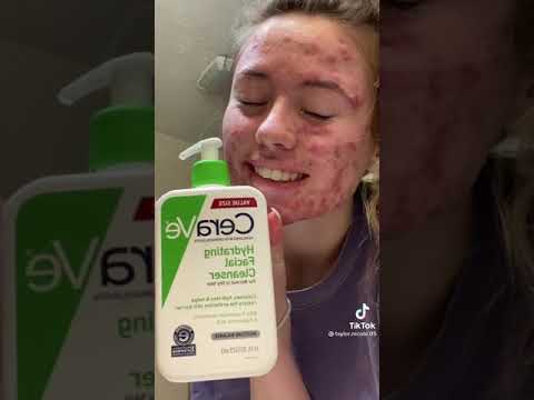 I Do This Every Day For Big Pimples On My Face