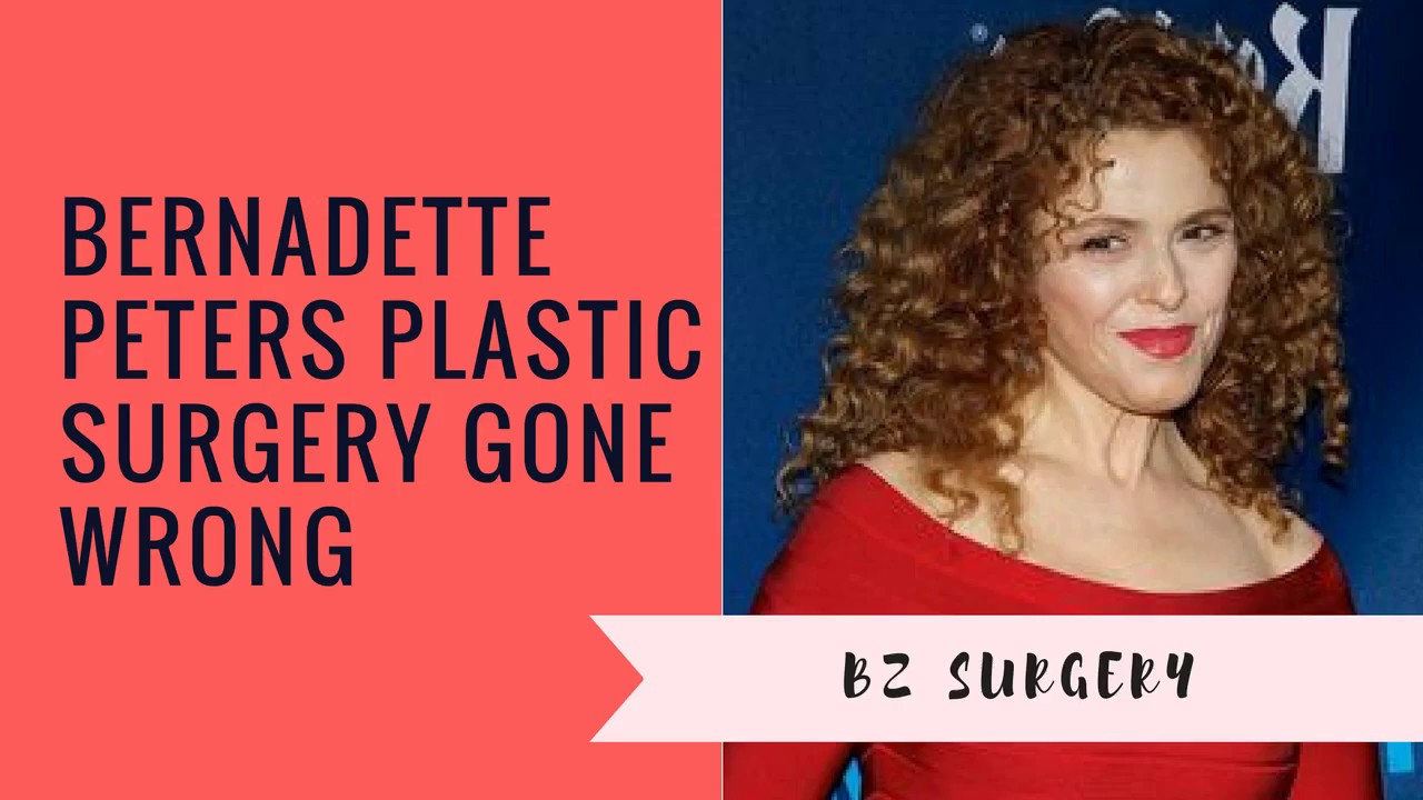 Bernadette Peters Plastic Surgery Gone Wrong