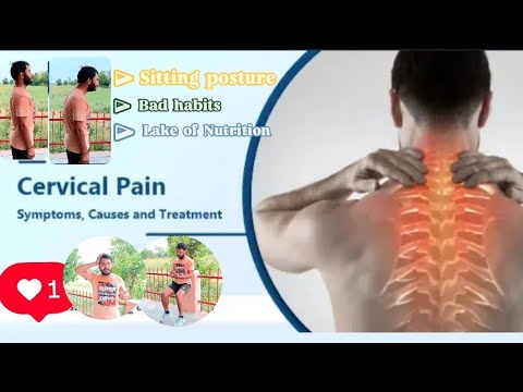 Cervical causes, symptoms,pain relief exercises & health tips #healthtips #viralvideo #cervicalpain