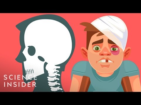 What Your Brain Is Like With A Concussion