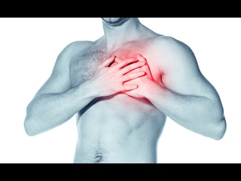 Prinzmetal's Variant Angina