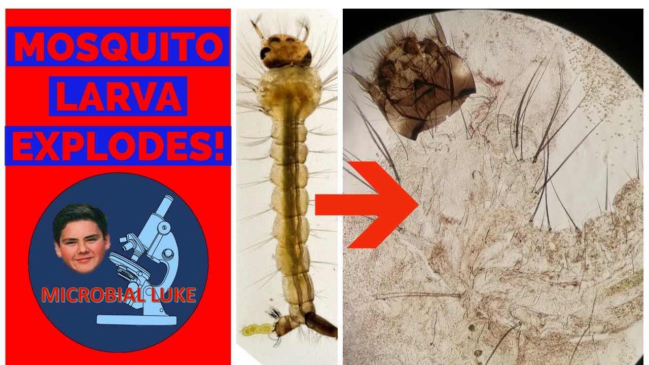 Mosquito Larvae Under A Microscope! | Microscope Monday