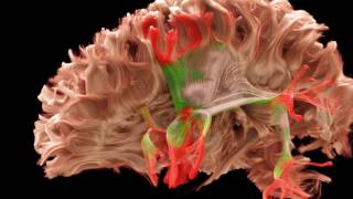 The most detailed scan of the wiring of the human brain - News ...