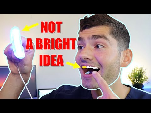 7 Day Teeth Whitening Results !!