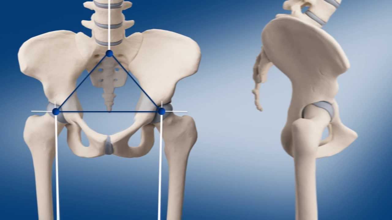 Individualized artificial hip joint (Doctors version english) - 3D Animation Medizin
