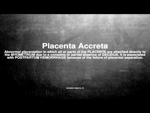 Medical vocabulary: What does Placenta Accreta mean