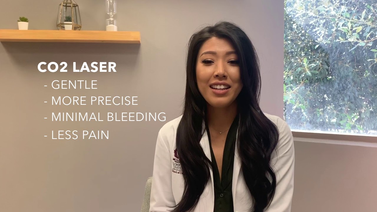Frenectomy FAQ's: Why a CO2 laser?