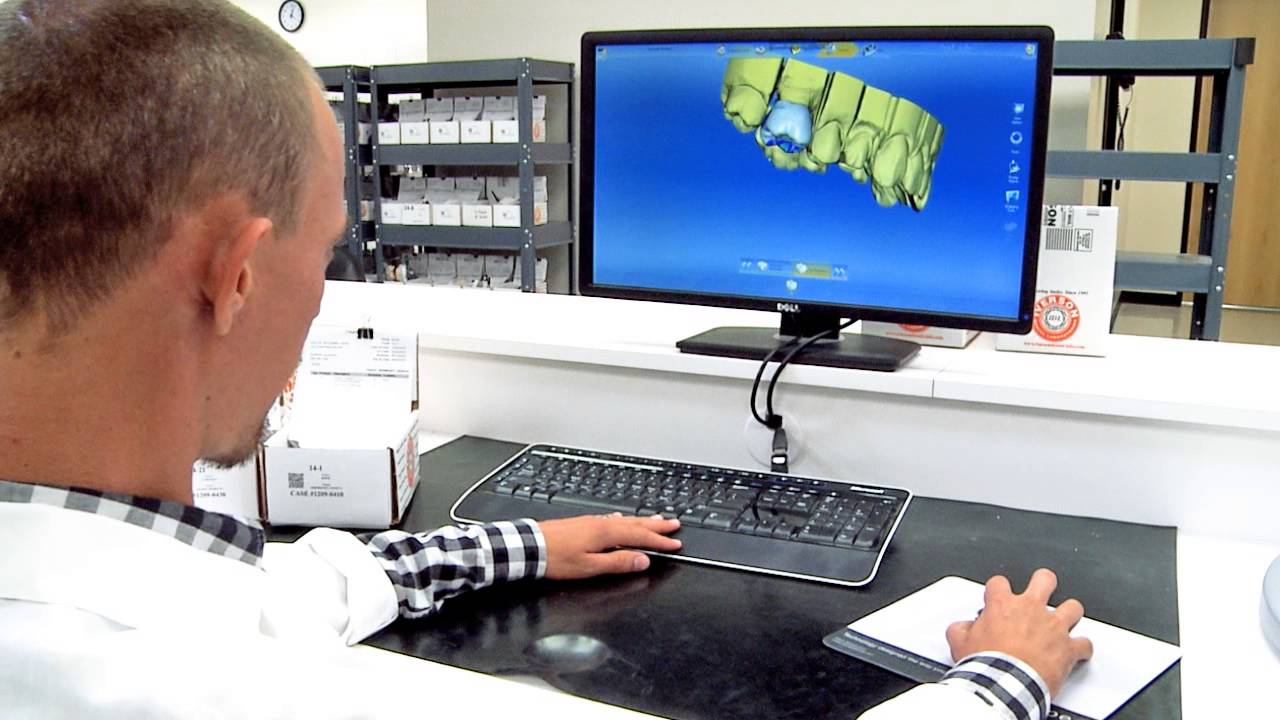 Iverson Dental Laboratories Behind the Scenes CAD CAM Department