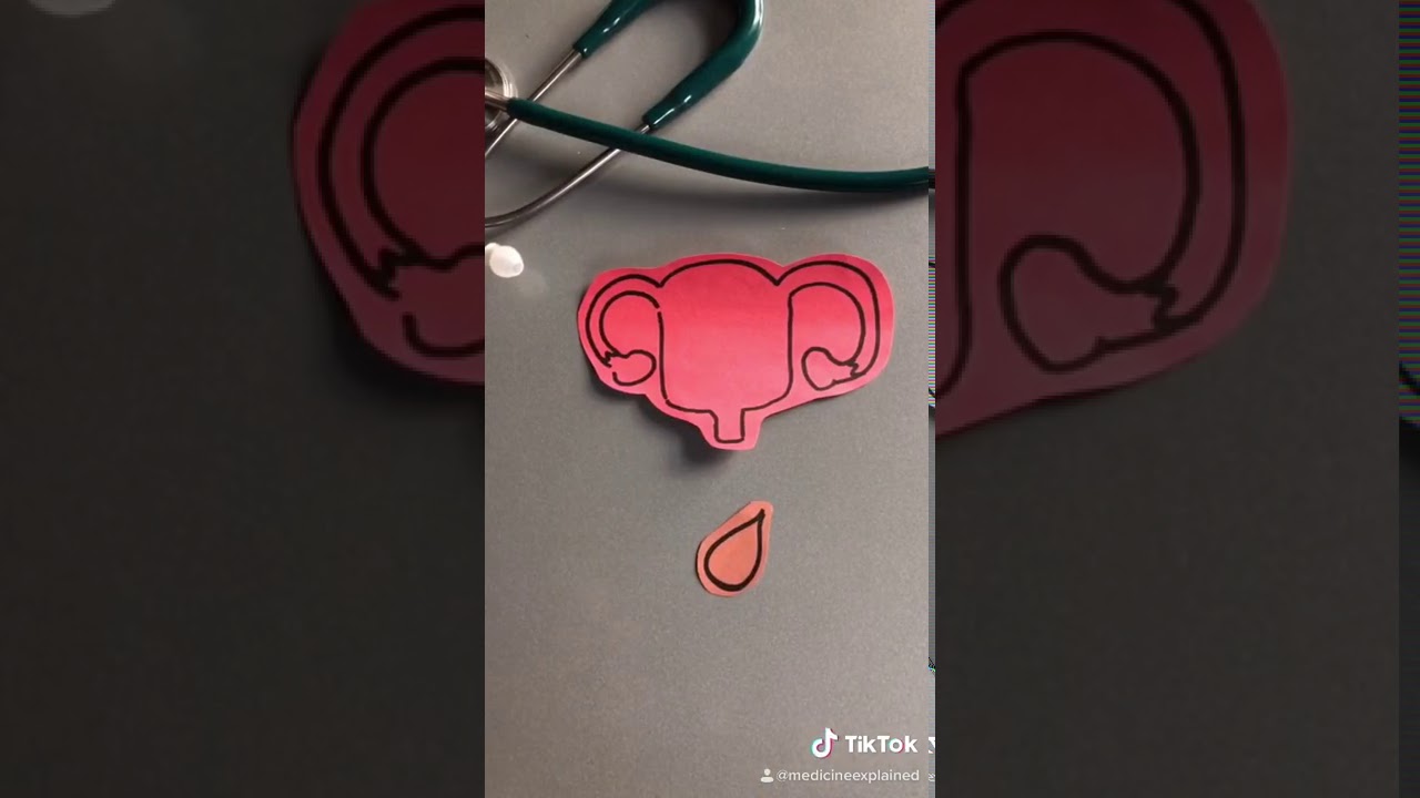 Is a brown period normal? #Shorts #MedicineExplained