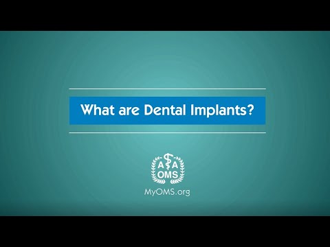 What are Dental Implants?