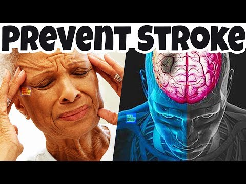 How Can You PREVENT STROKES? Protect Yourself From A STROKE By ...