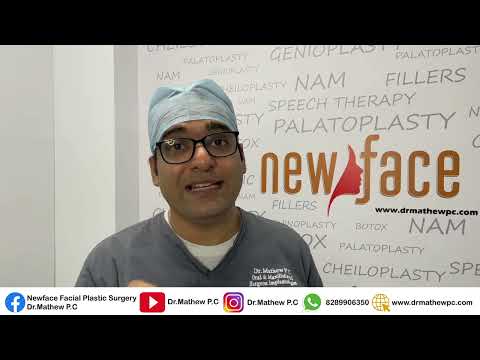 Why should Cleft Palate surgery be done at a very early stage? Hear from Dr.Mathew P.C