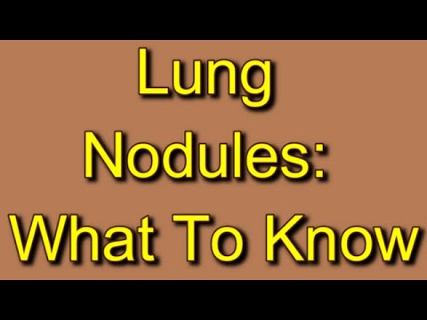 Lung Nodules: What To Know