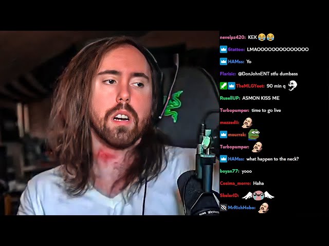 "You're neck is red?": Dispelling rumors of self-harm, Asmongold ...