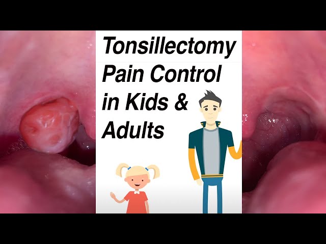 Tonsillectomy Healing Stages Tonsillitis Quinsy Abscess
