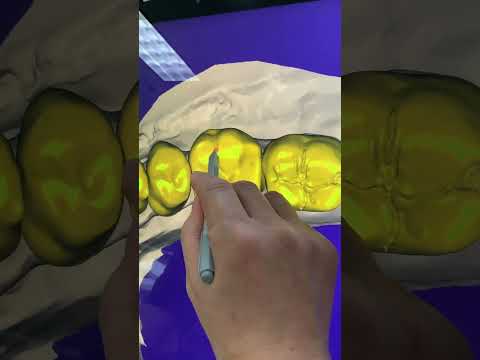 Handcrafting Teeth Digitally
