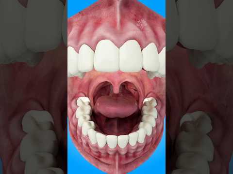 How Tonsil Stones Are Formed #short #tonsilstones - creativelearning3d