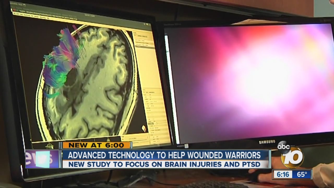 Advanced technology helping Wounded Warriors