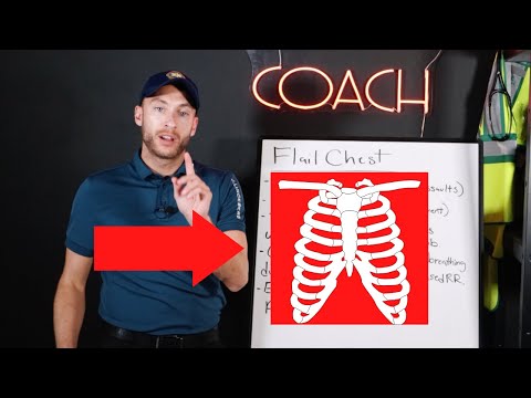FLAIL CHEST Causes & Treatment Explained