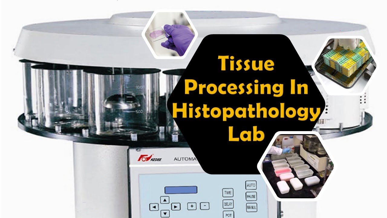 Tissue Processing | Histopathology | E-Learn with Zakir|
